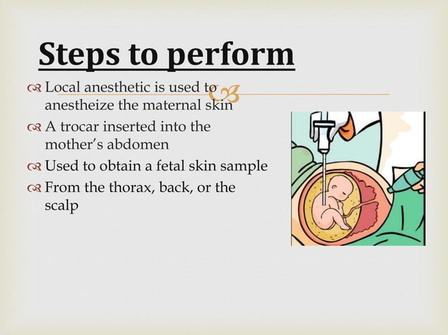 prenatal Diagnosis of genetic Disorders | PPT