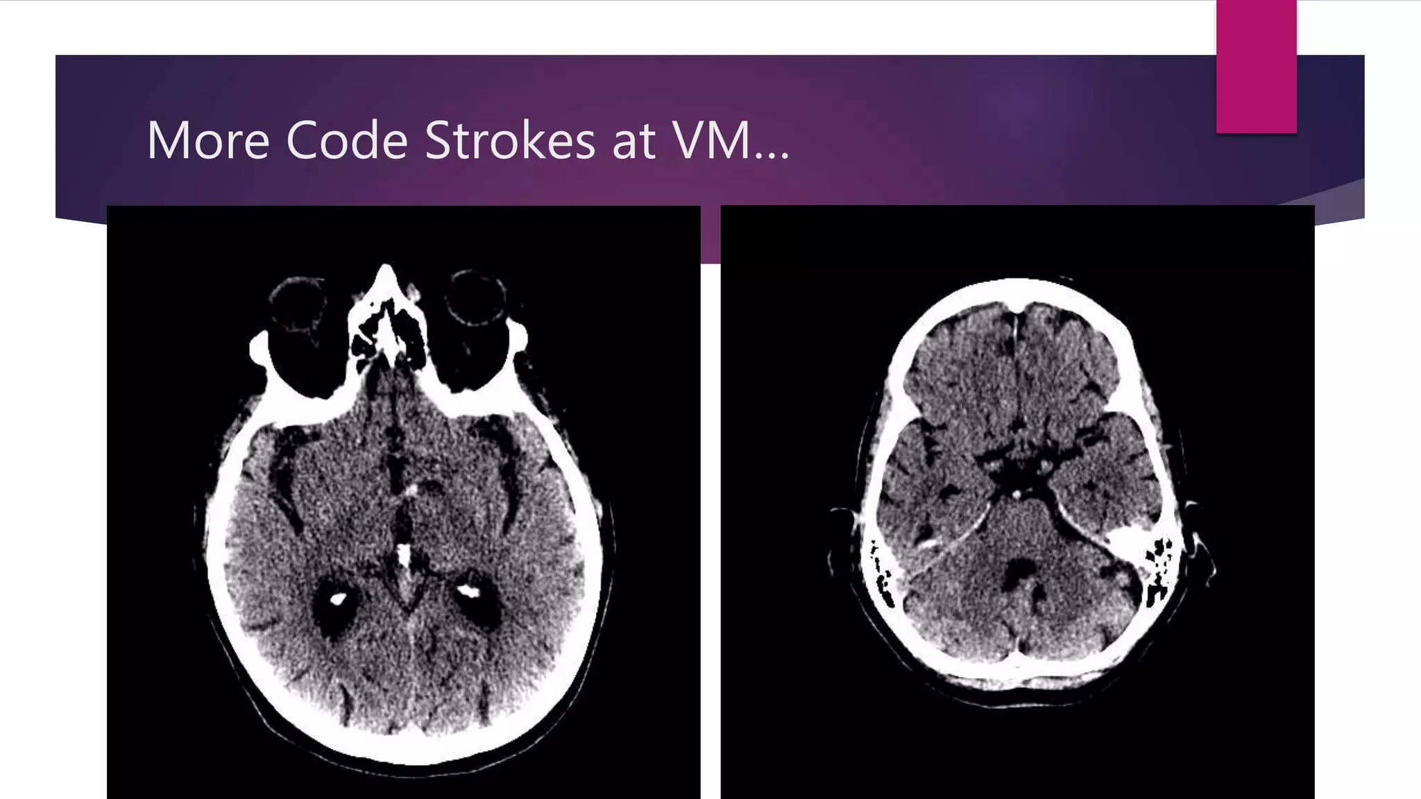 Intro to ct head prr | PPT