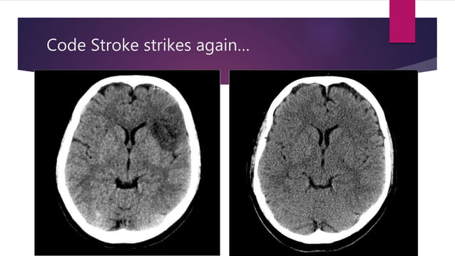 Intro to ct head prr | PPT