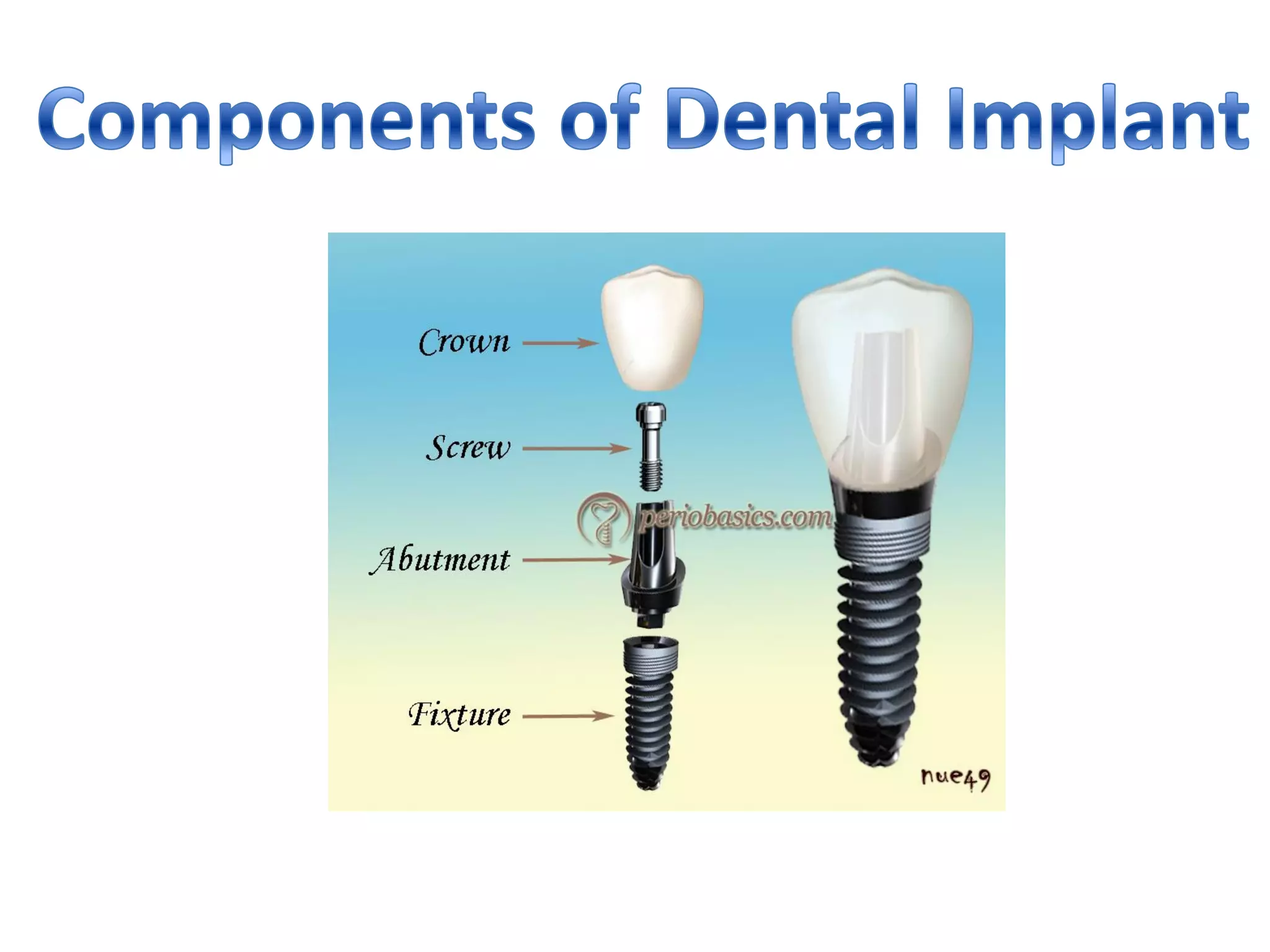 Introduction to Dental Implants | PDF