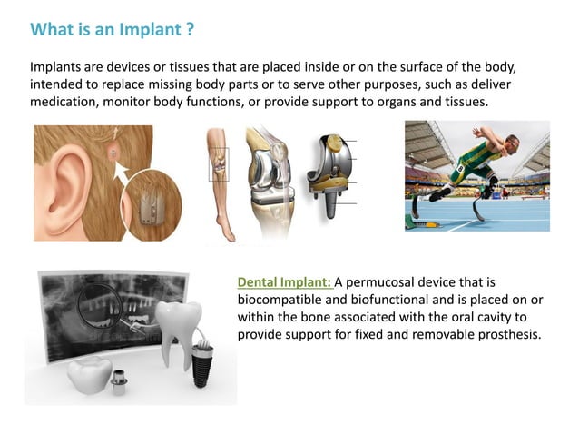 Introduction to Dental Implants | PDF | Bone and Joint Conditions ...
