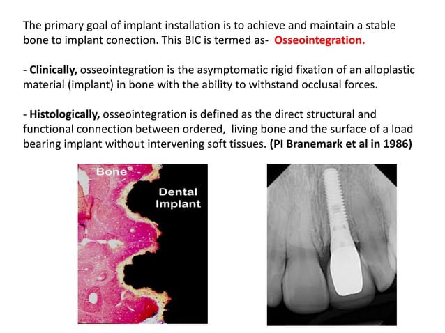 Introduction to Dental Implants | PDF | Bone and Joint Conditions ...