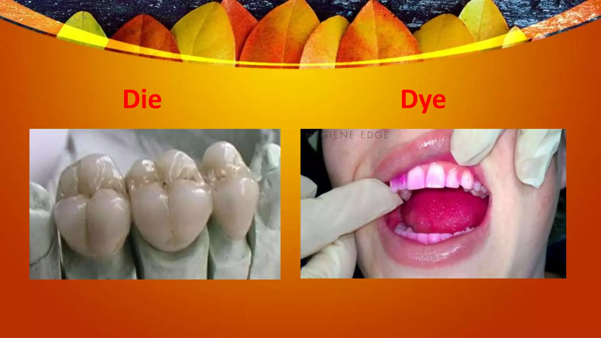 Intro to dental terminology | PPTX