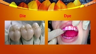 Intro to dental terminology | PPTX