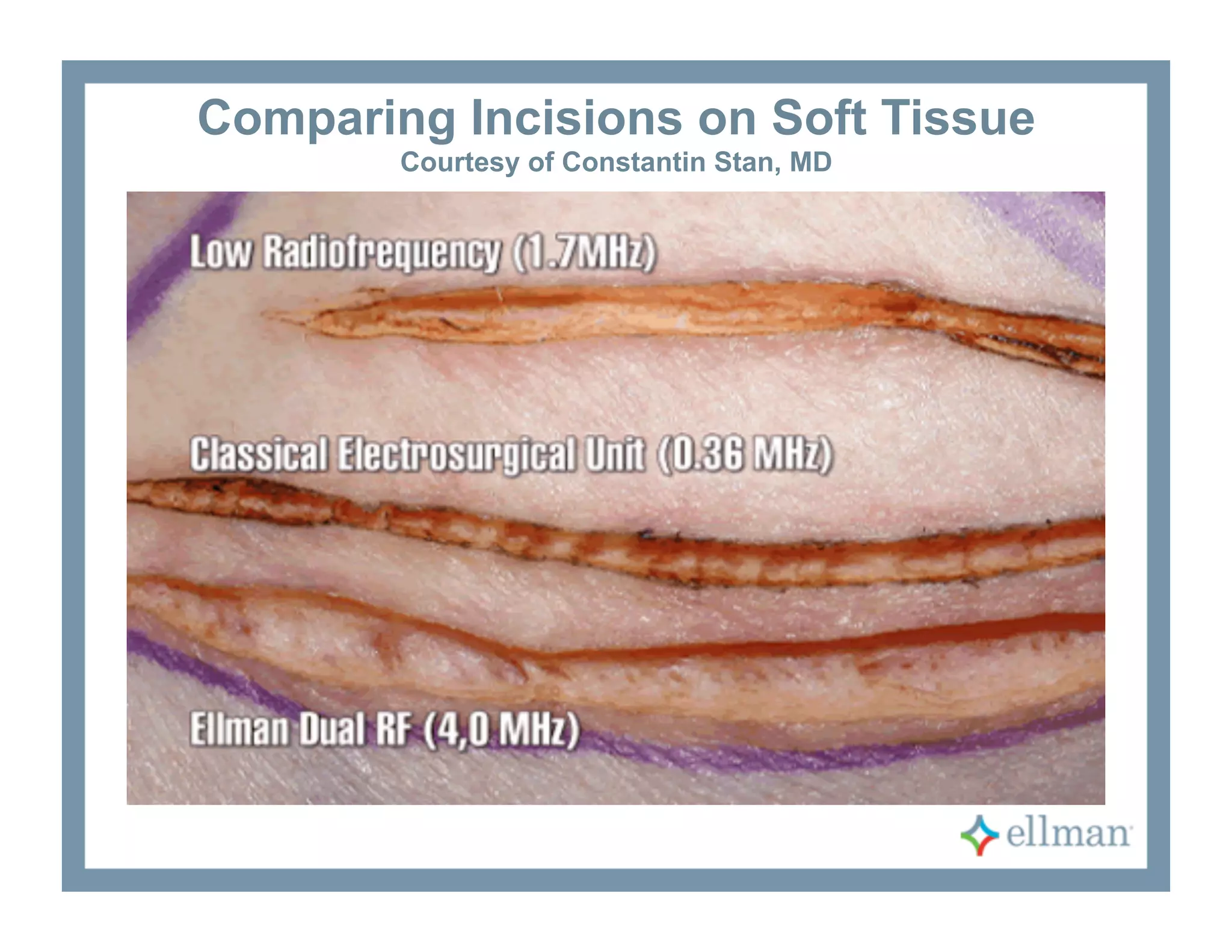 Intro to Ellman Part 1/5 (RF vs. ESU) | PDF