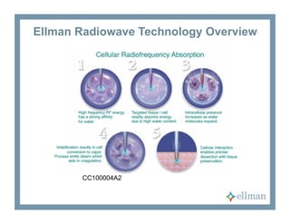 Intro to Ellman Part 1/5 (RF vs. ESU) | PDF