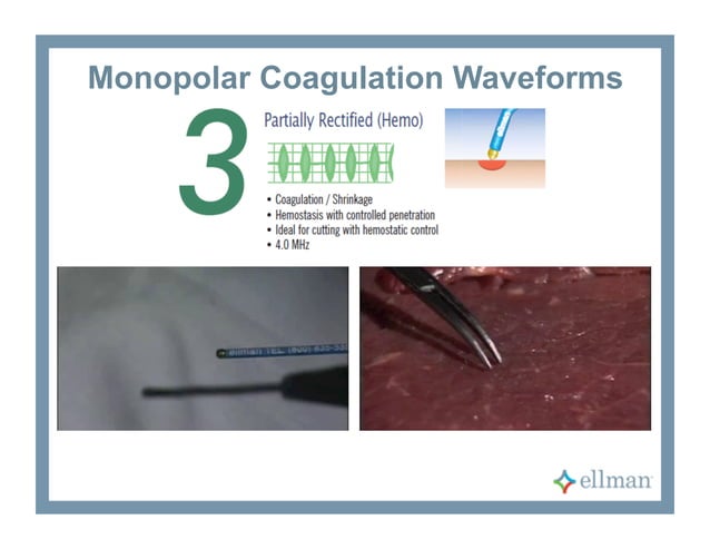 Intro to Ellman Part 1/5 (RF vs. ESU) | PDF