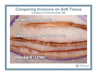 Intro to Ellman Part 1/5 (RF vs. ESU) | PDF