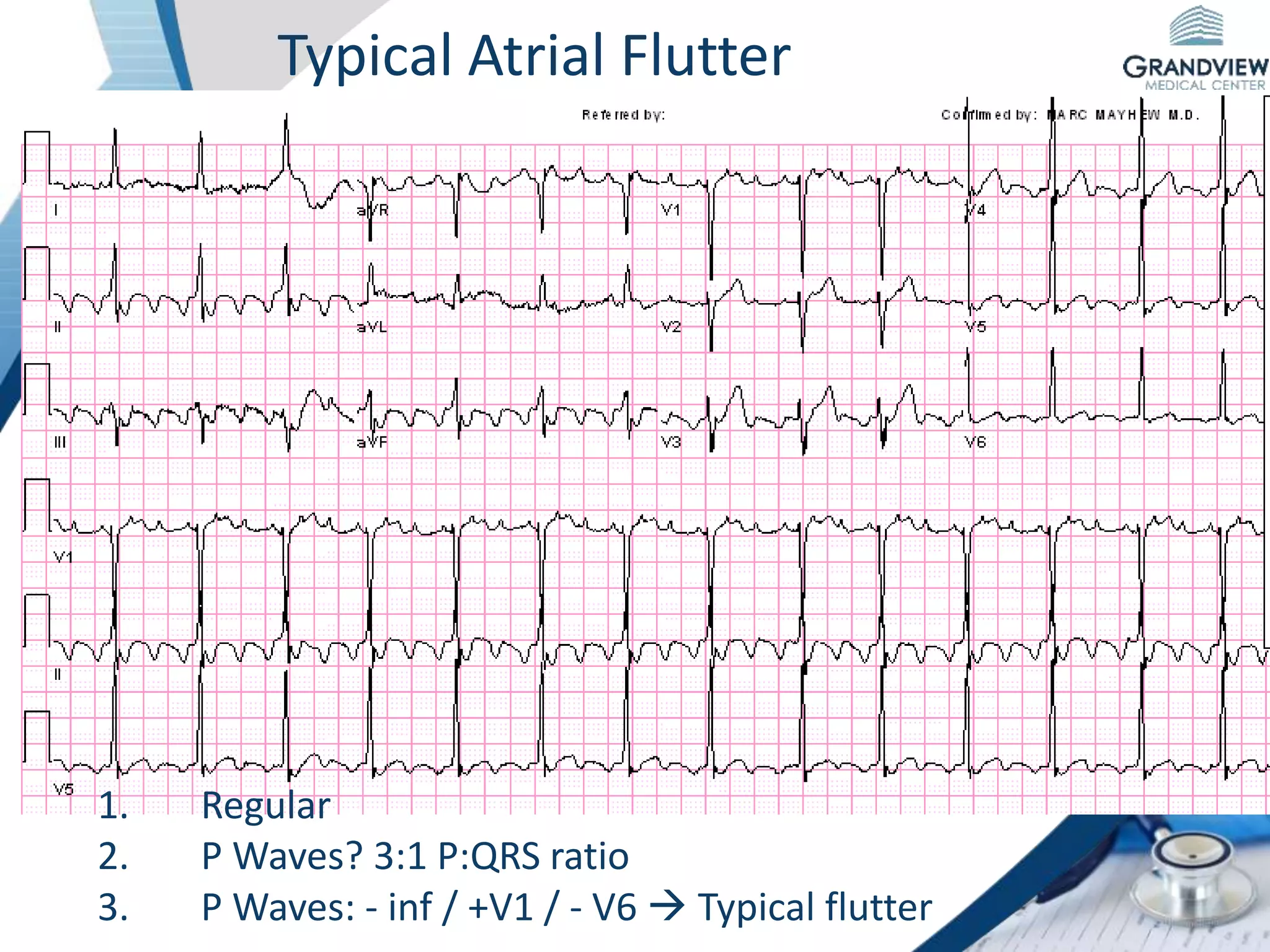 Introduction to Electrophysiology - Supraventricular Tachycardias (1/4 ...