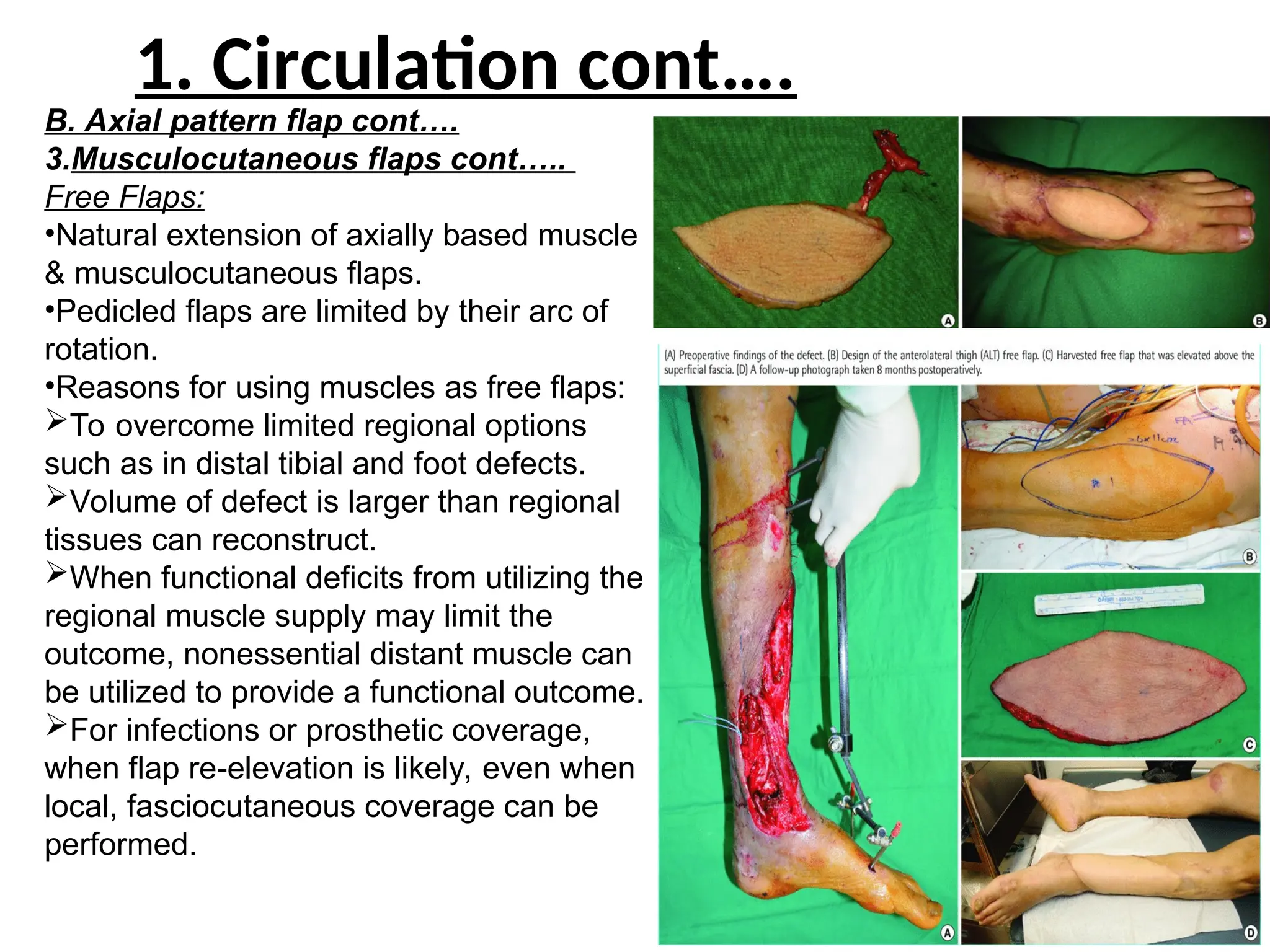 introduction to flaps presentation pptx. | PPT