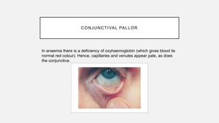 Intro to hematological system | PPT