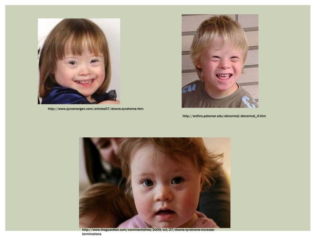 The Application of the Human Phenotype Ontology | PPT