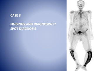 Introduction to Bone Scan: Techniques and Diagnosis | PPTX
