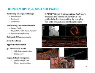 INTRO TO OCT & SYSYTEM.pptx