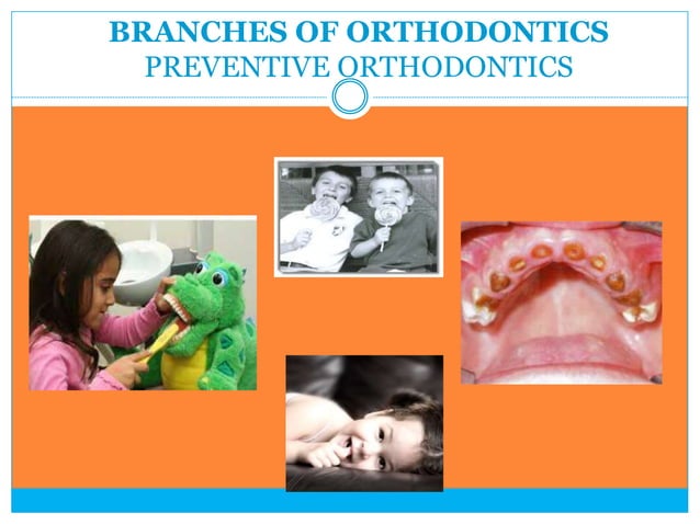 Introduction to orthodontics | PPTX