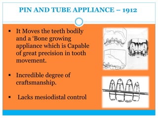 Introduction to orthodontics | PPT