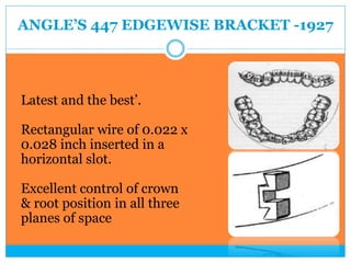 Introduction to orthodontics | PPT
