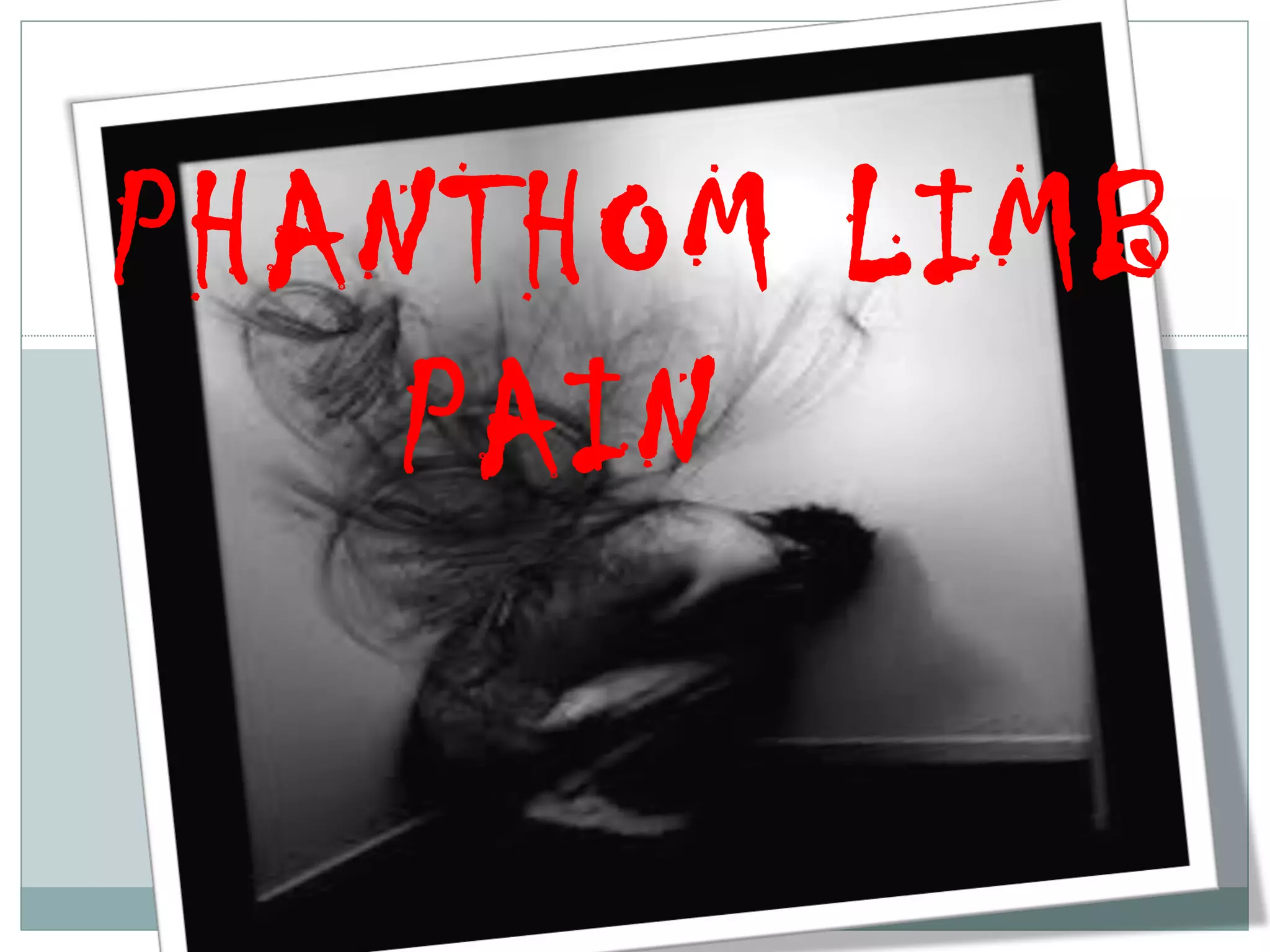 Intro to phantom limb pain | PPT
