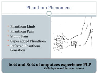 Intro to phantom limb pain | PPT