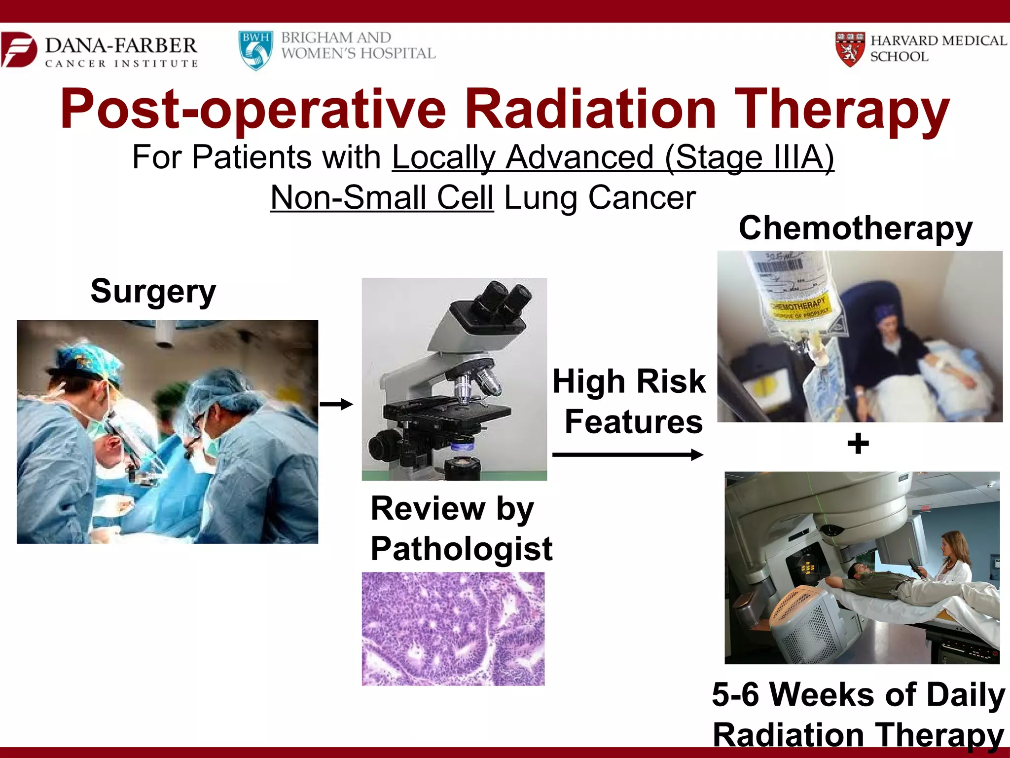How is Radiation Therapy Used to Help Lung Cancer Patients? | PPT