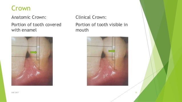 Intro two dental anatomy
