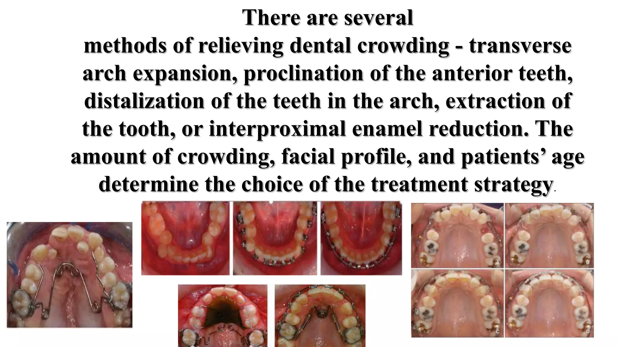 Intrproximal reduction as part of orthodontic treatment | PPTX