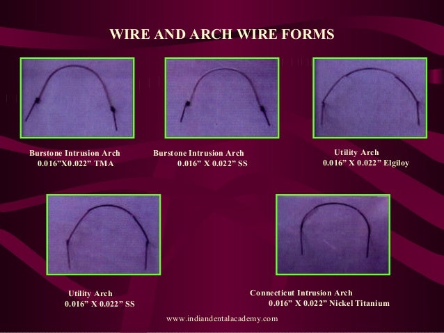 Intrusion in orthodontics