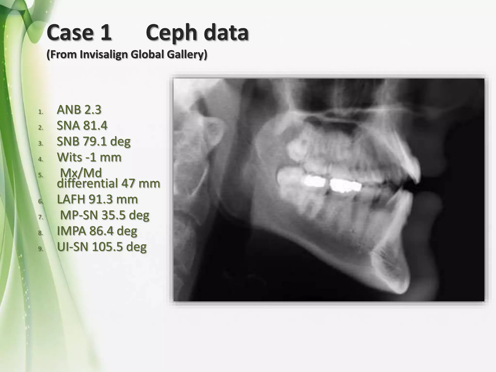 Intrusion and extrusion Invisalign | PPTX