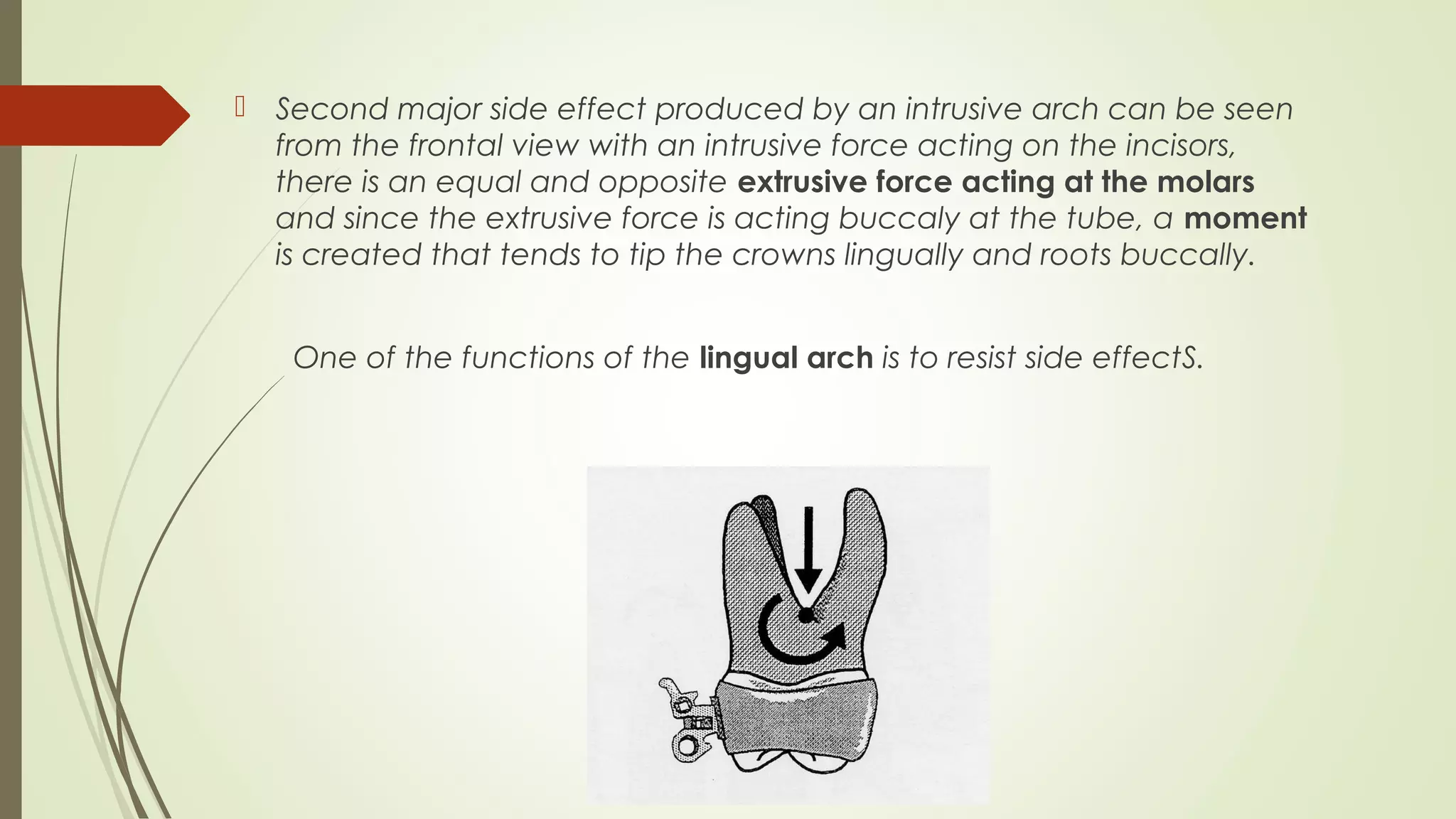 Intrusion arches | PPT