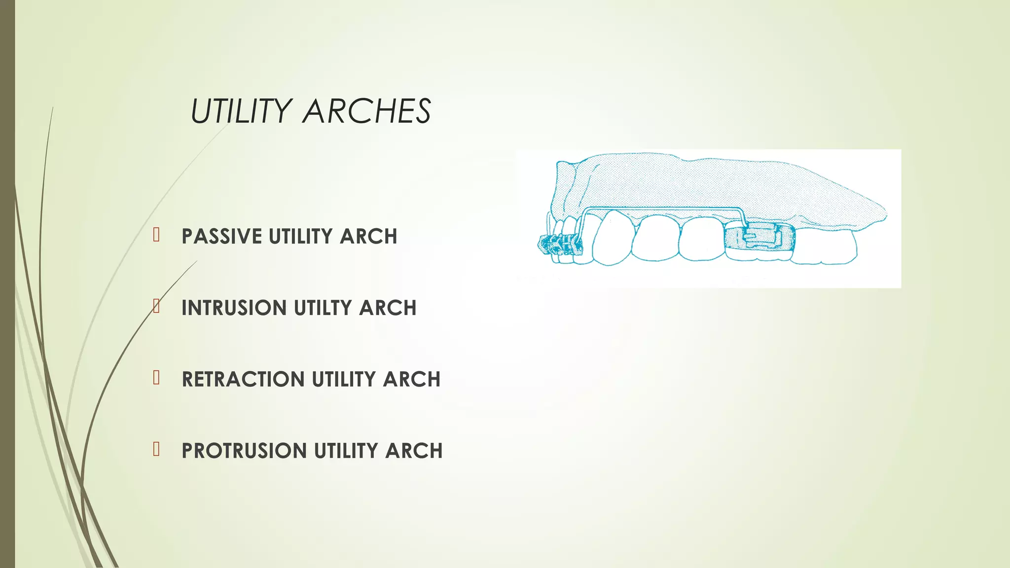 Intrusion arches | PPT