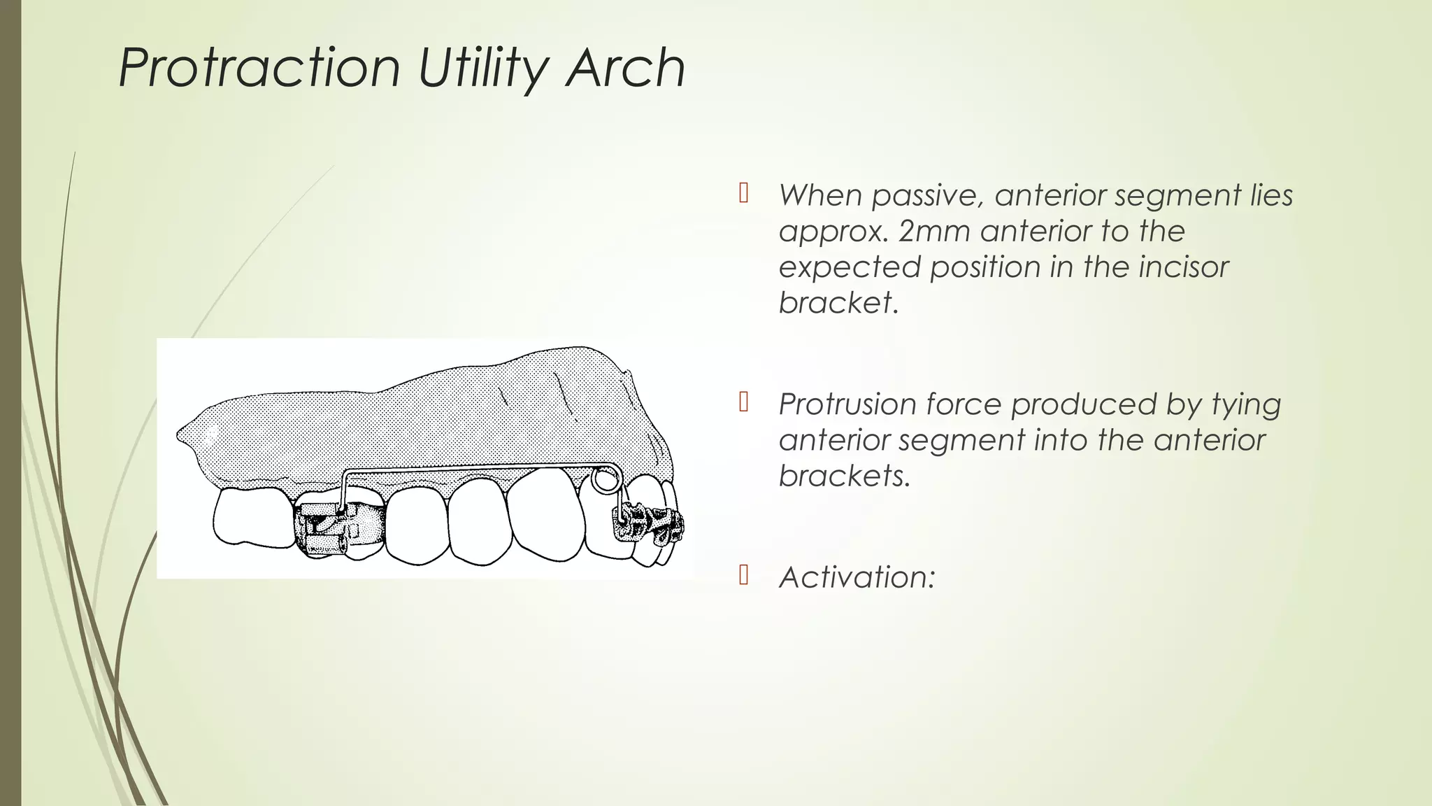 Intrusion arches | PPT