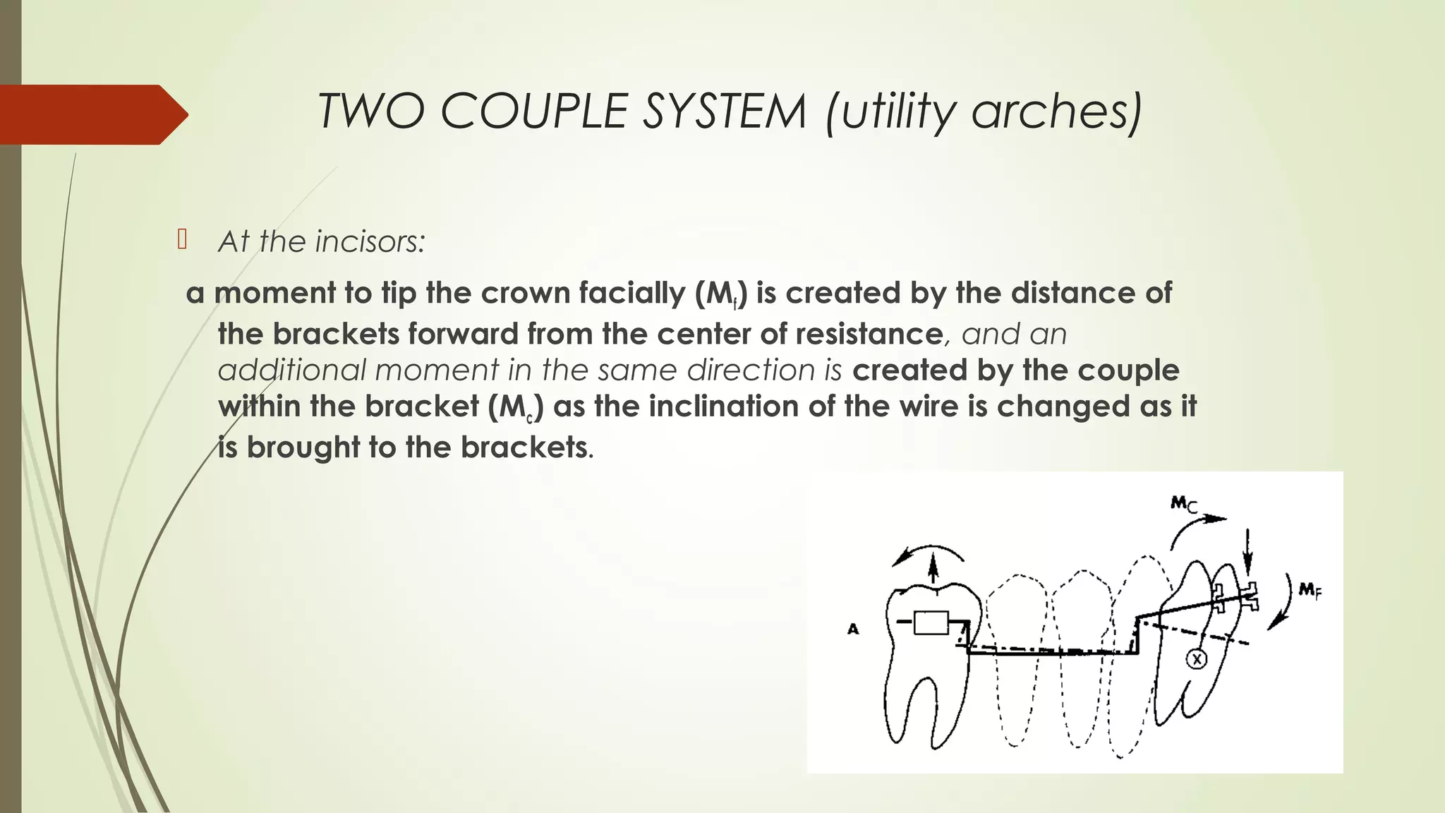 Intrusion arches | PPT