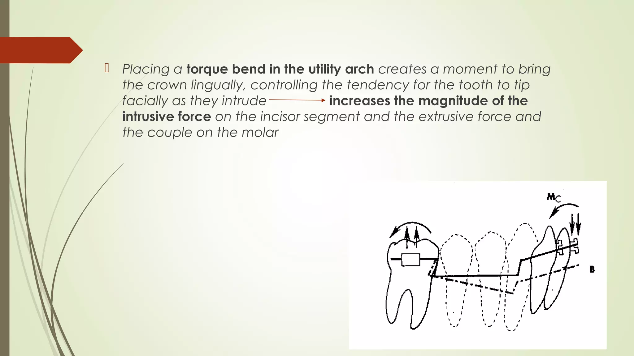 Intrusion arches | PPT