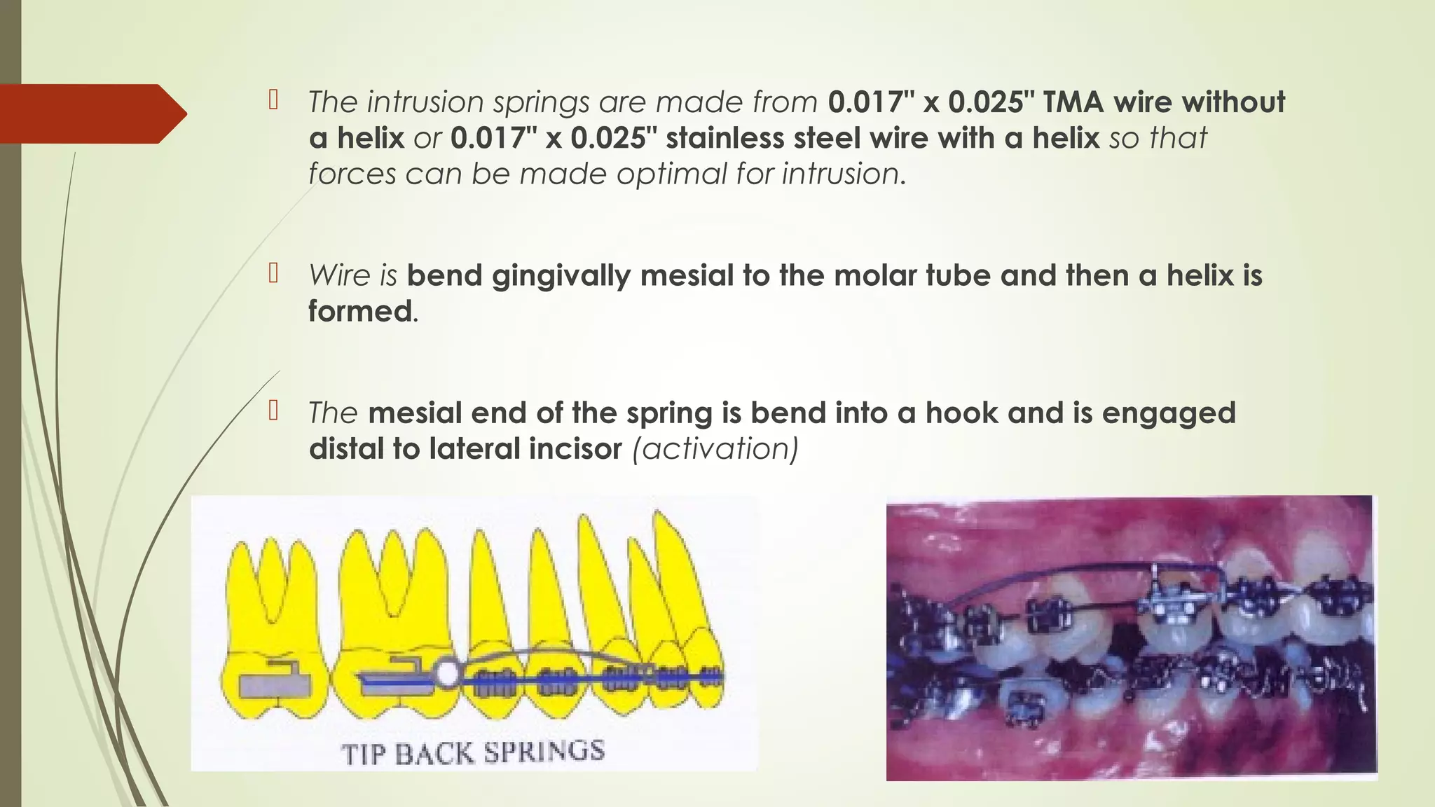 Intrusion arches | PPT