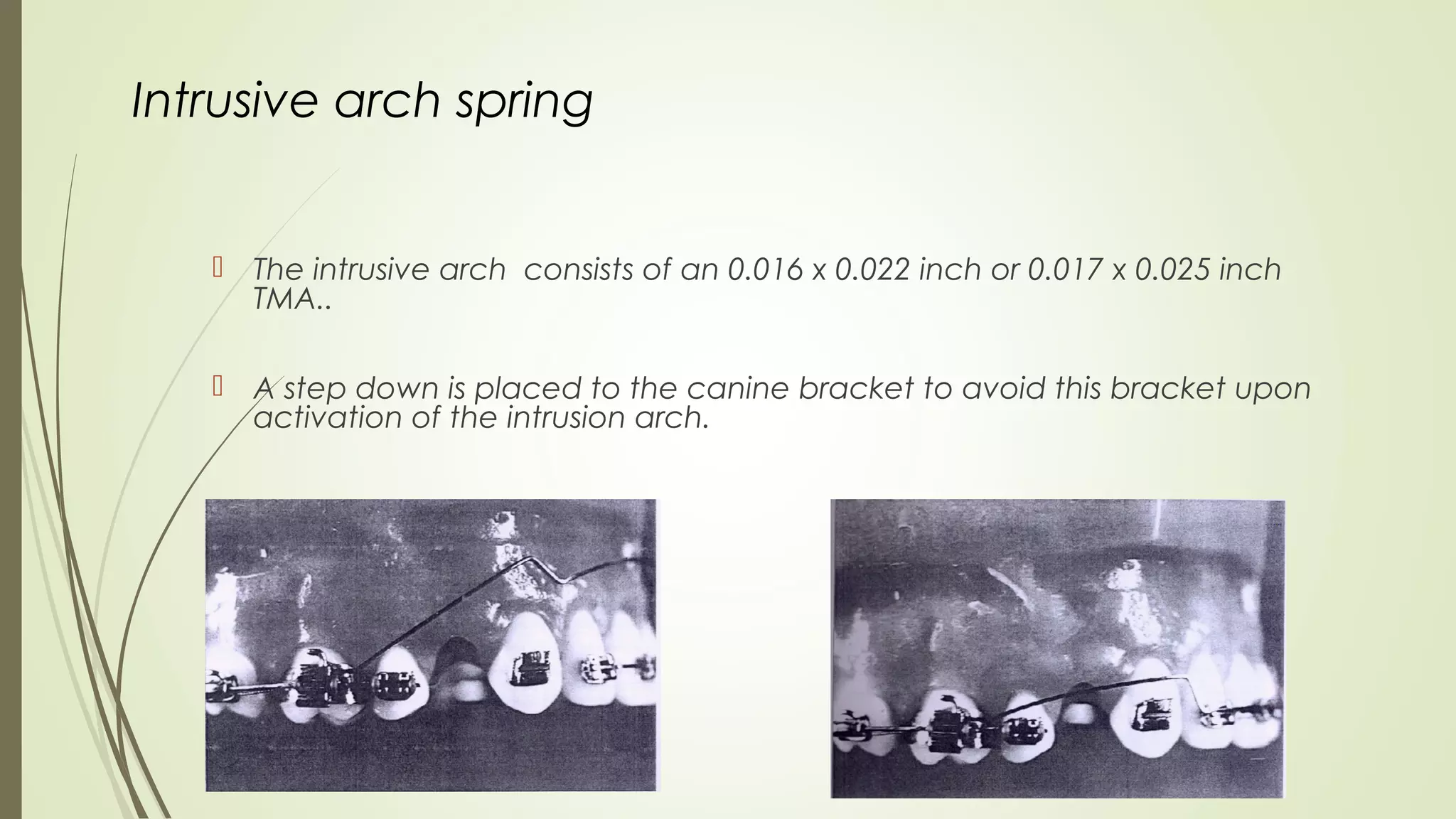 Intrusion arches | PPT