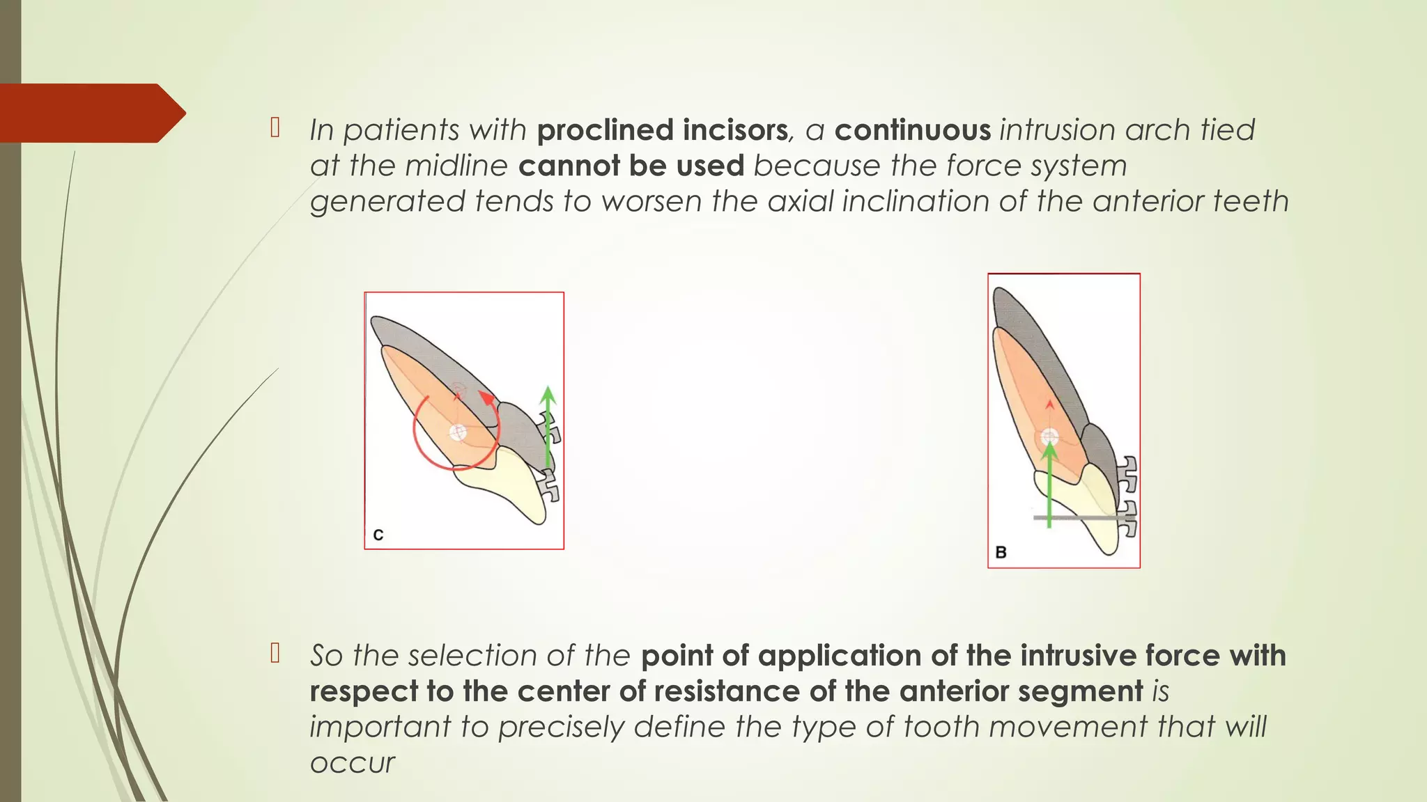 Intrusion arches | PPT