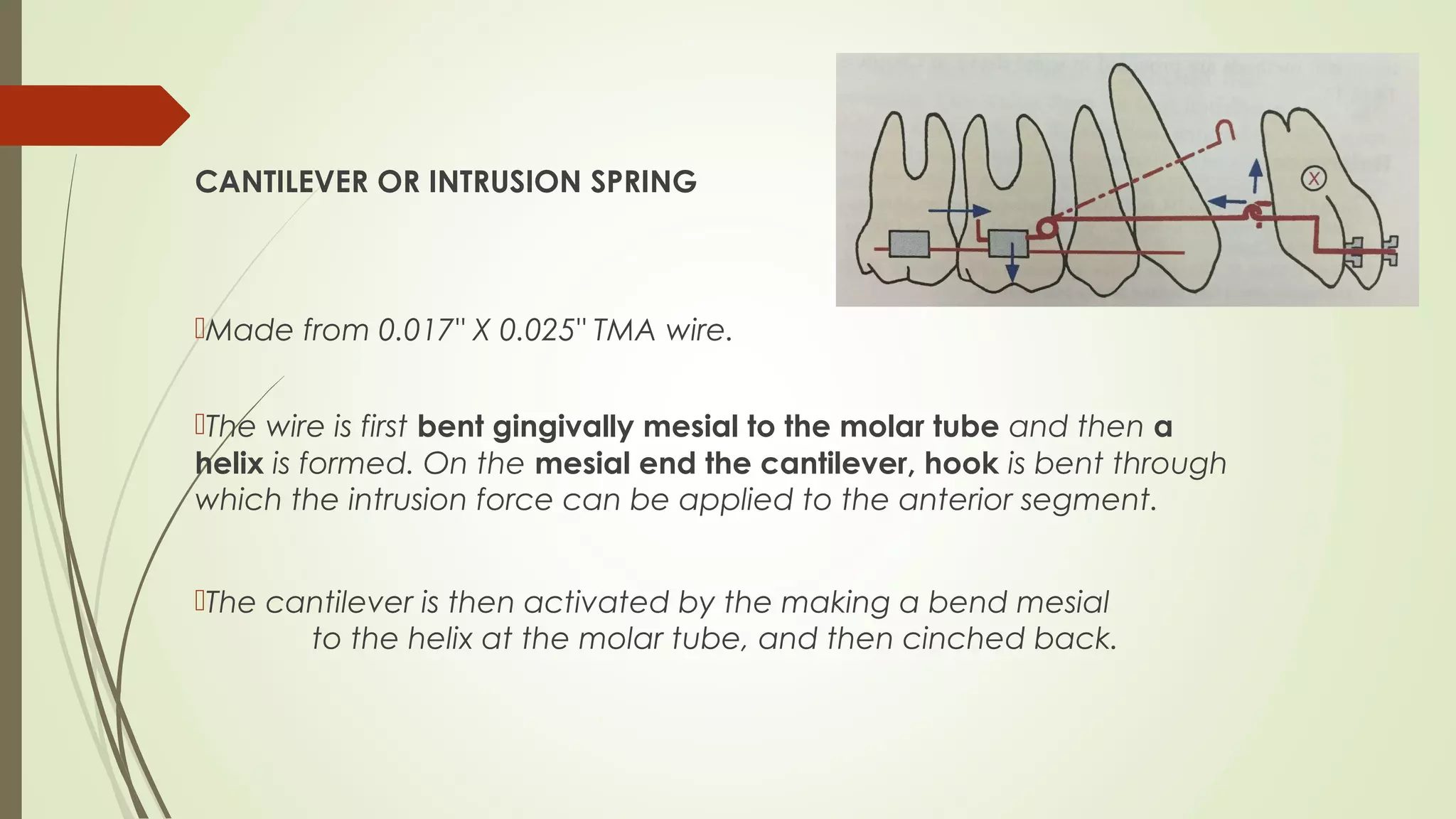 Intrusion arches | PPT