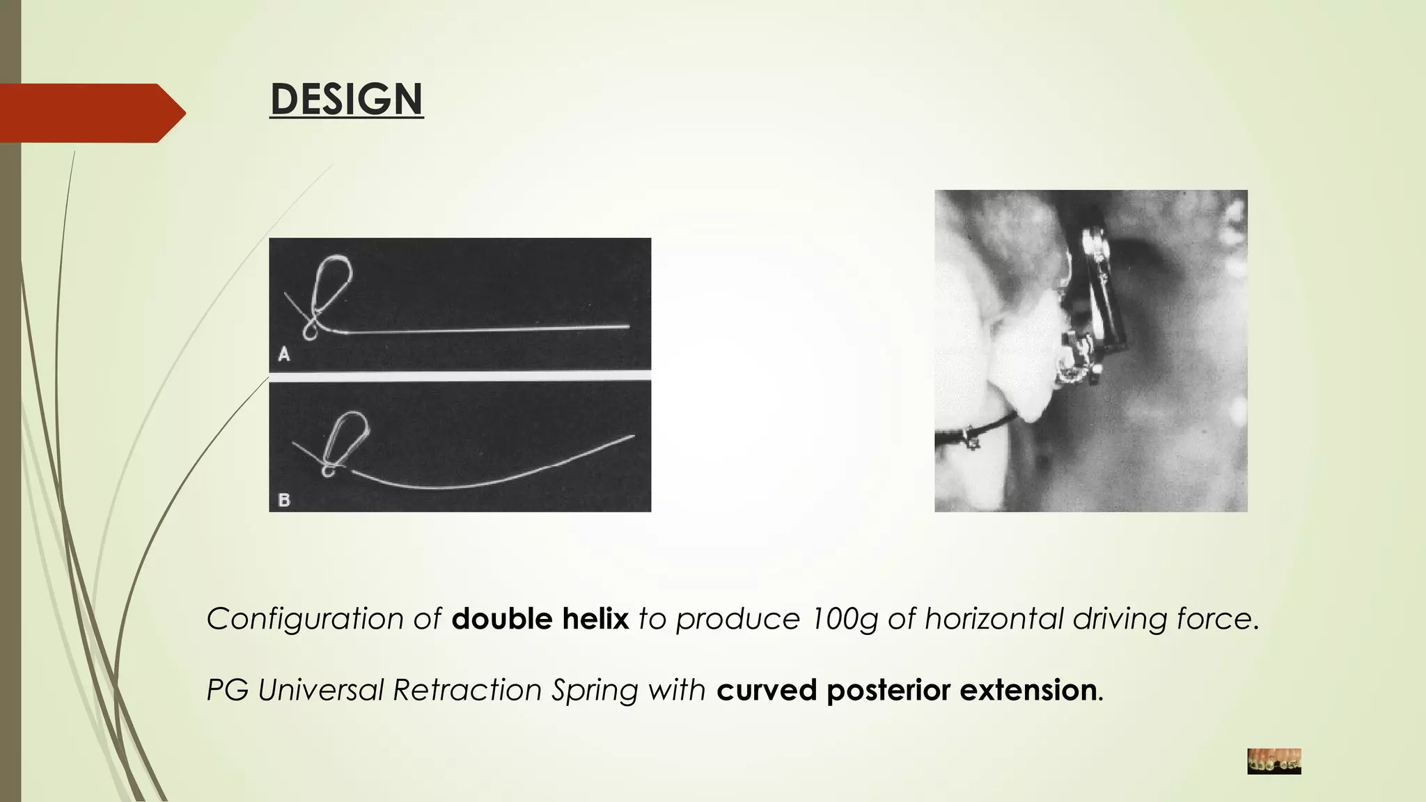 Intrusion arches | PPT