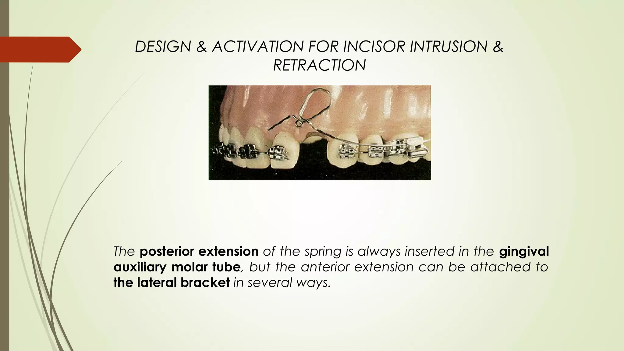 Intrusion arches | PPT