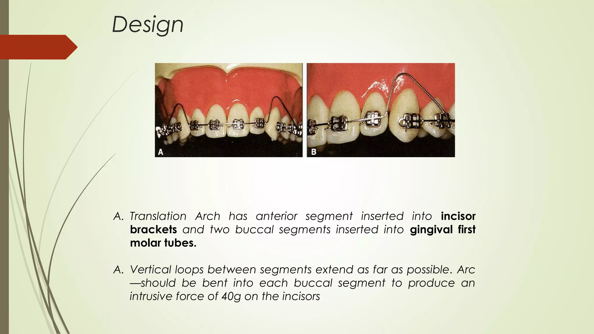 Intrusion arches | PPT