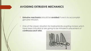 Intrusion arches | PPT