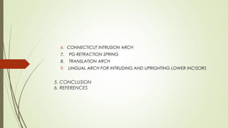 Intrusion arches | PPT