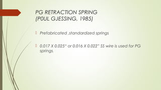 Intrusion arches | PPT