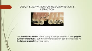 Intrusion arches | PPT