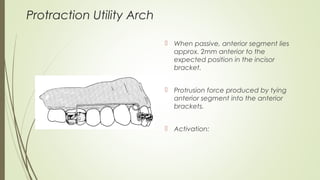 Intrusion arches | PPT
