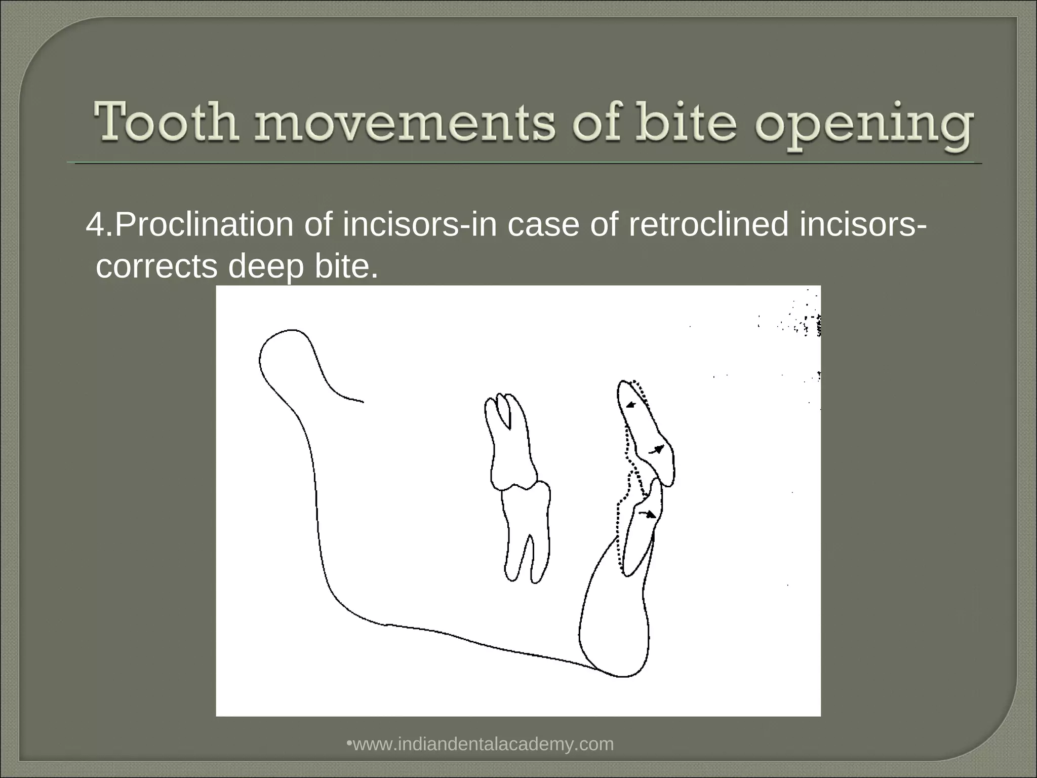 Intrusion arches /certified fixed orthodontic courses by Indian dental ...