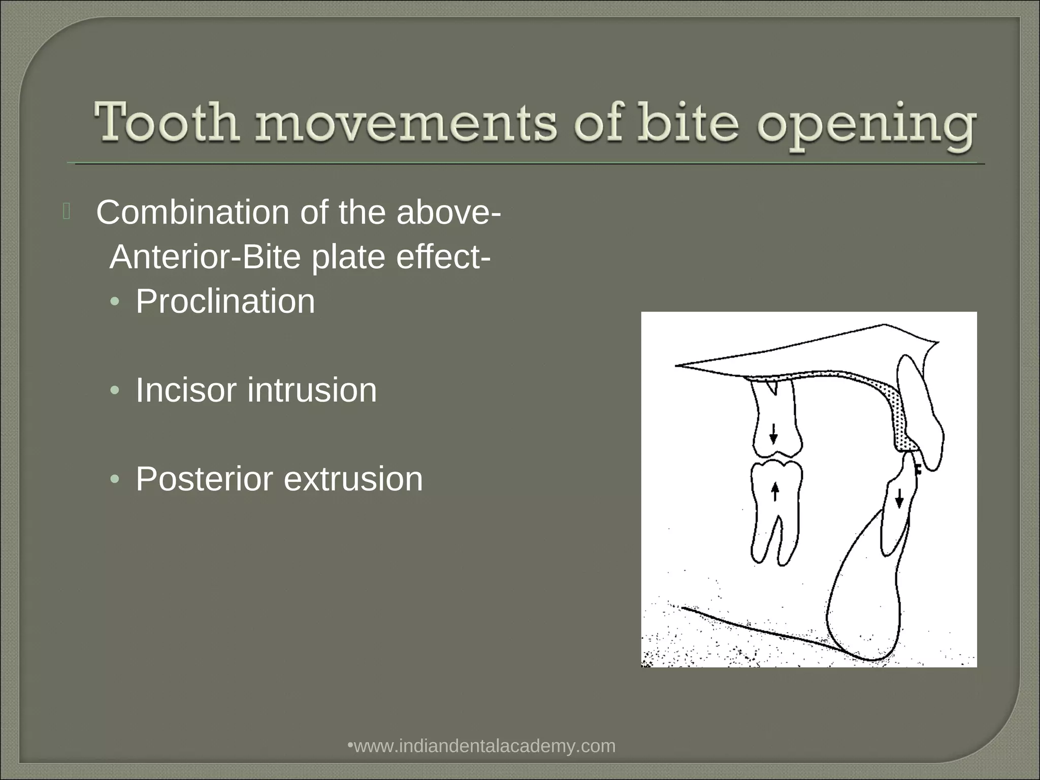 Intrusion arches /certified fixed orthodontic courses by Indian dental ...