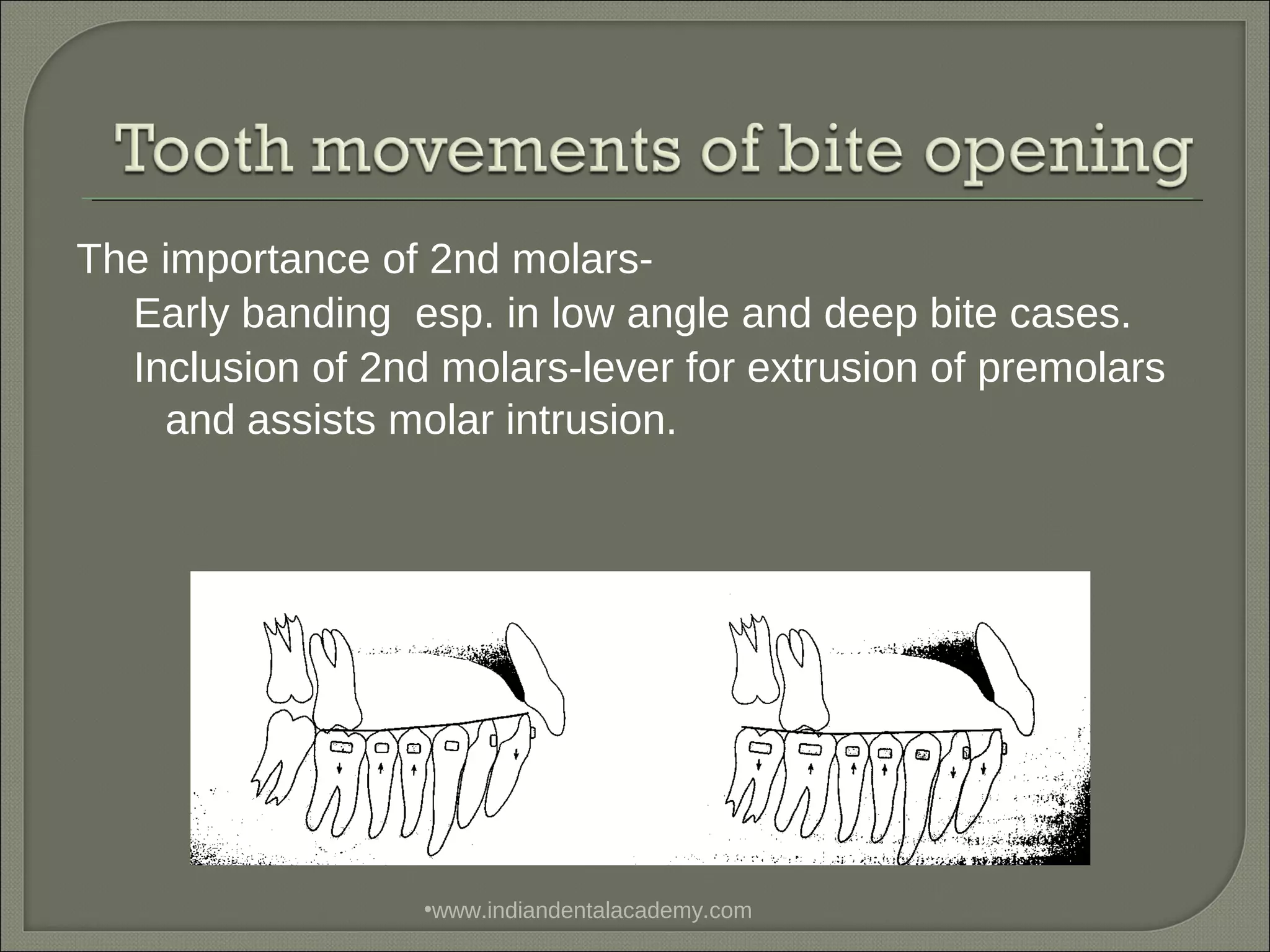 Intrusion arches /certified fixed orthodontic courses by Indian dental ...