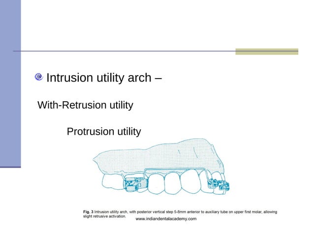 Intrusion arches /certified fixed orthodontic courses by Indian dental ...