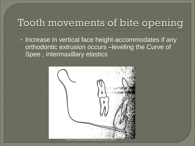 Intrusion arches /certified fixed orthodontic courses by Indian dental ...